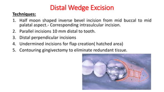 Periodontal surgery | PPTX