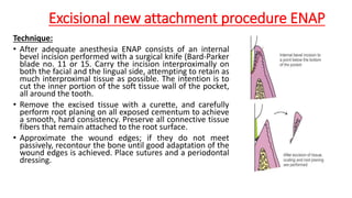 Periodontal surgery | PPTX