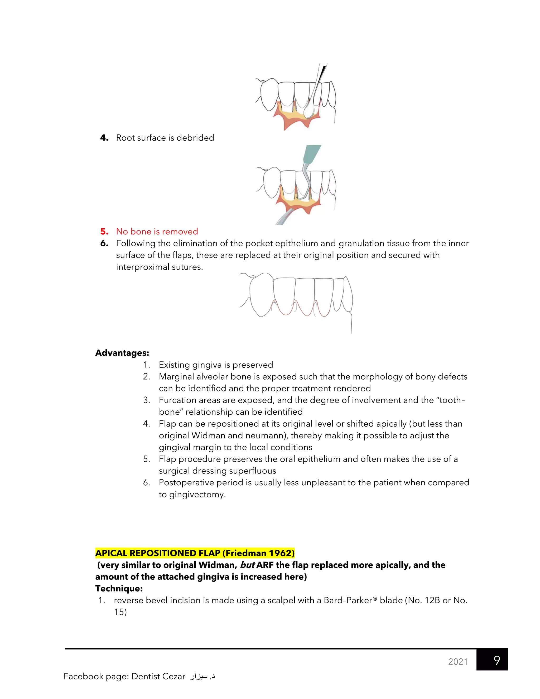 Periodontal surgery Access Therapy | PDF
