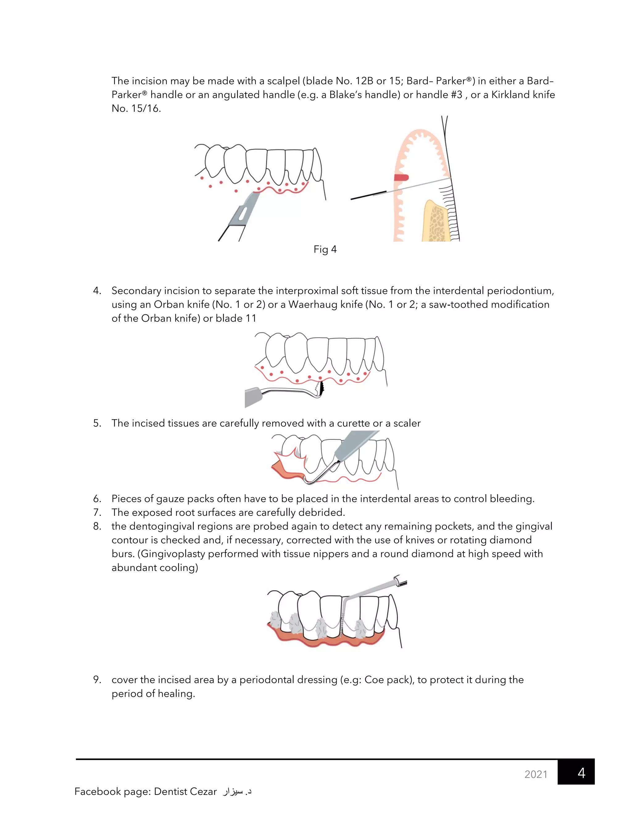 Periodontal surgery Access Therapy | PDF