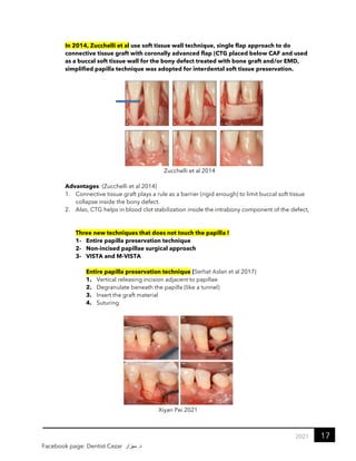Periodontal surgery Access Therapy | PDF