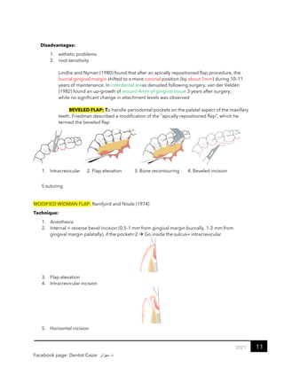 Periodontal surgery cezar pdf | PDF