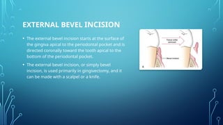 Periodontal Surgical Therapy.pptx materials | PPT