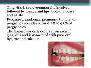 PERIODONTAL THERAPY IN FEMALE PATIENTS Presented by- Dr. Himanshu ...