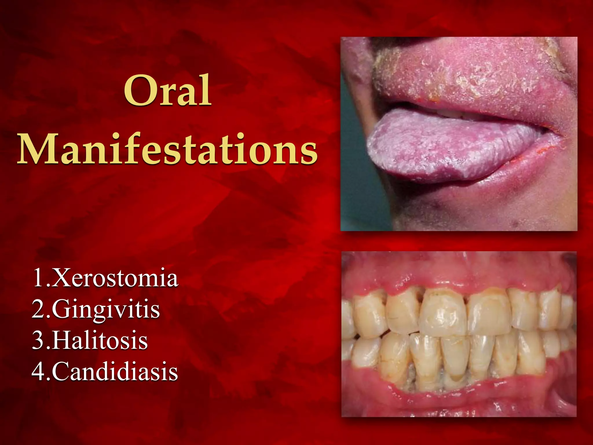 Periodontal treatment of medically compromised patients | PDF