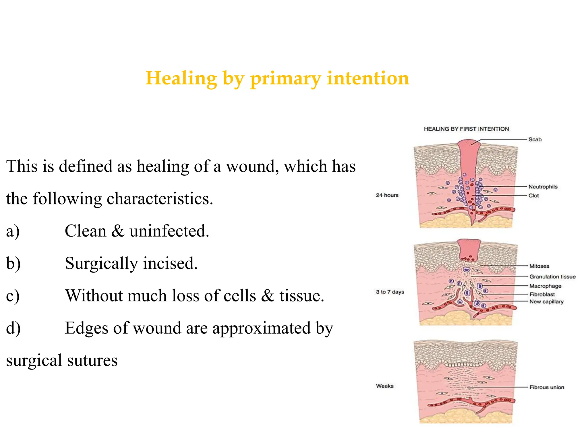 PERIODONTAL WOUND HEALING [Autosaved].pptx