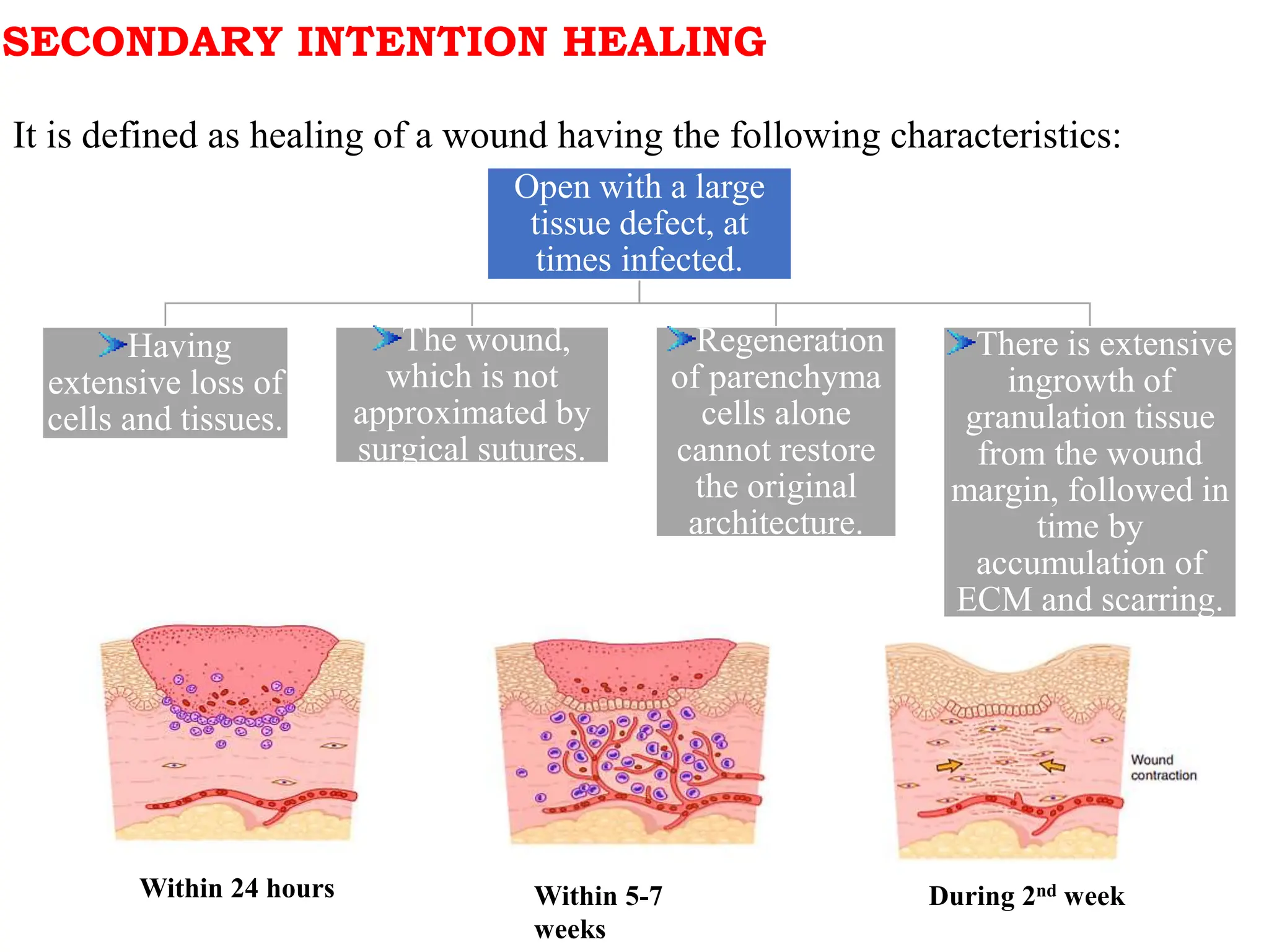 PERIODONTAL WOUND HEALING [Autosaved].pptx