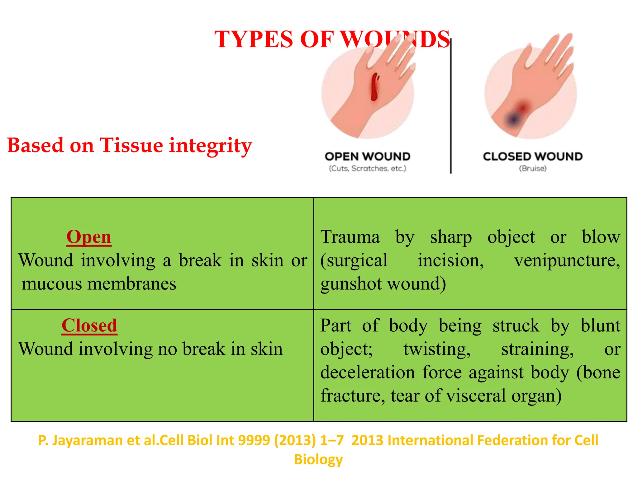 PERIODONTAL WOUND HEALING [Autosaved].pptx