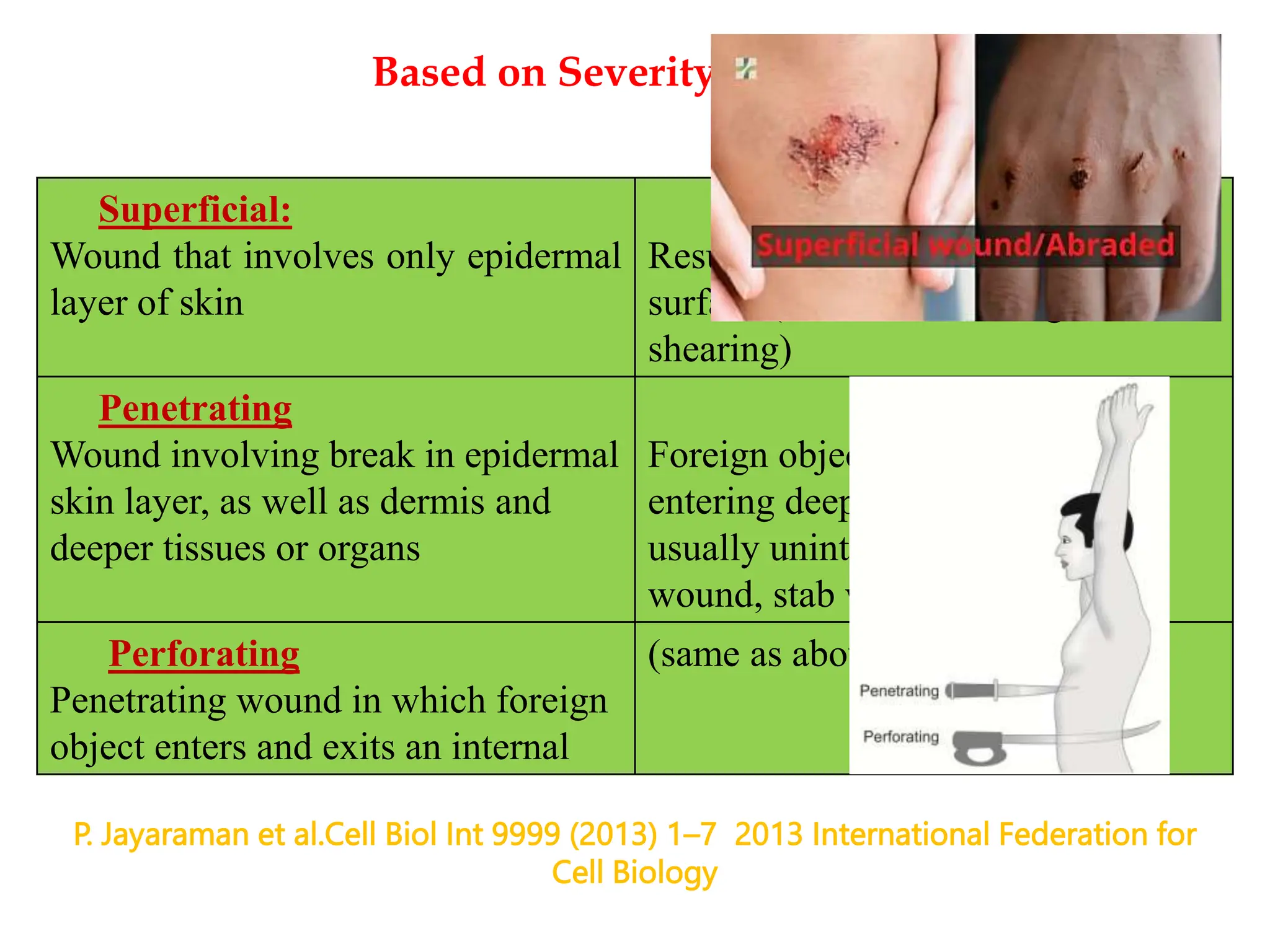 PERIODONTAL WOUND HEALING [Autosaved].pptx