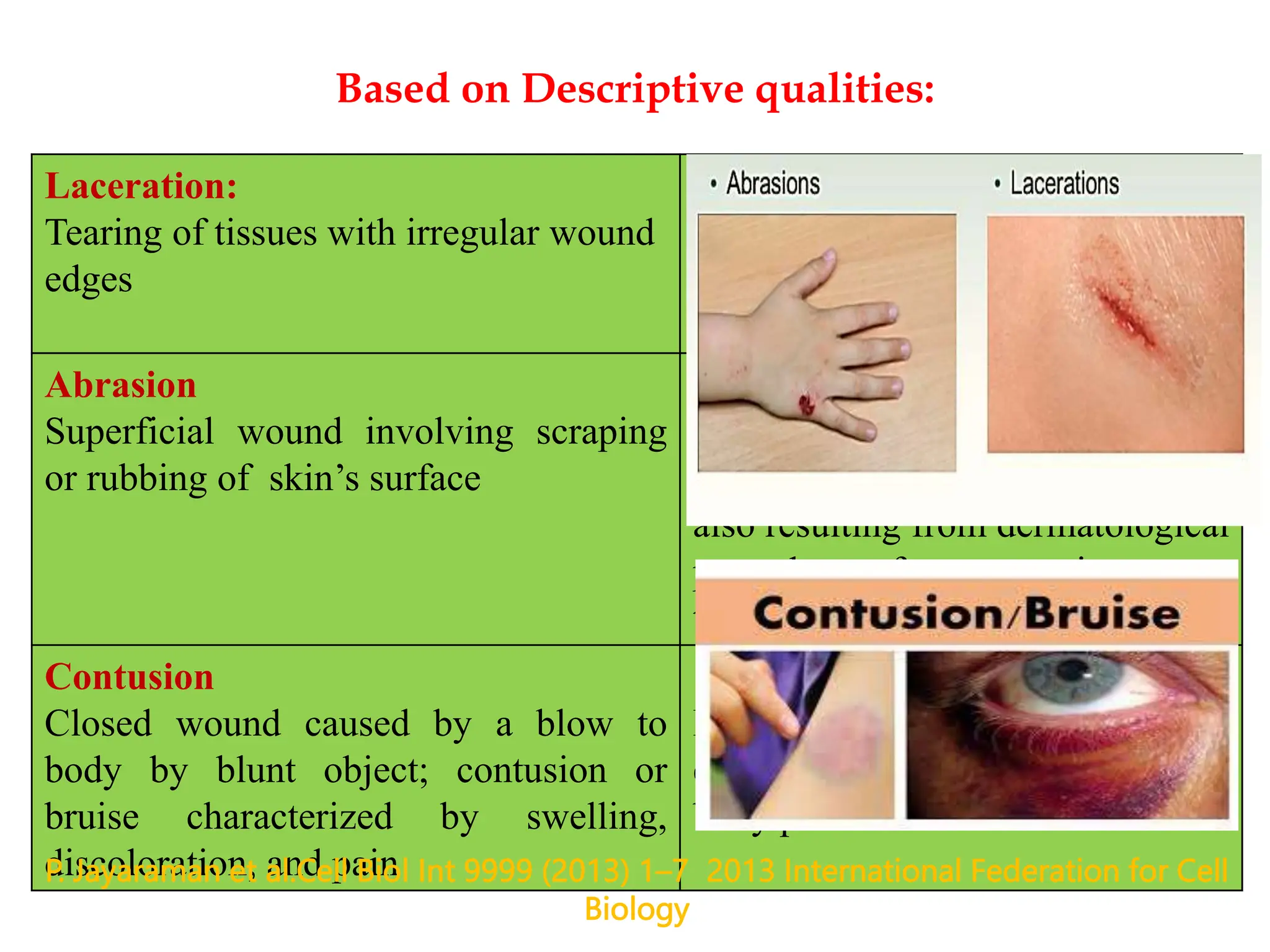PERIODONTAL WOUND HEALING [Autosaved].pptx
