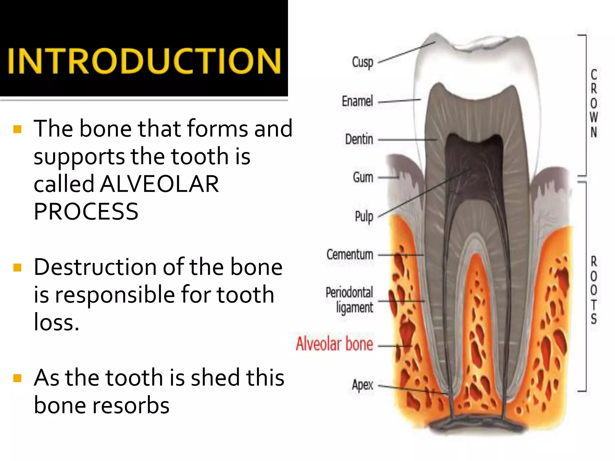 Bone destruction Periodontics *(ViRa)* | PPTX