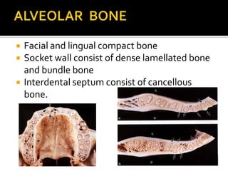 Bone destruction Periodontics *(ViRa)* | PPTX