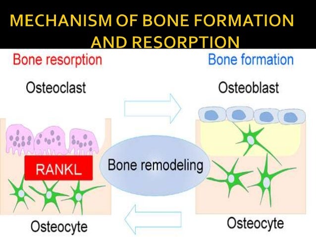 Bone destruction Periodontics *(ViRa)*