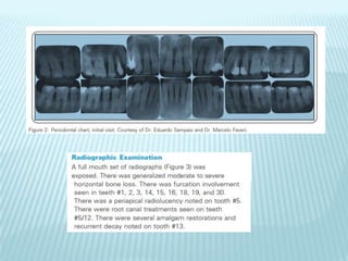 Periodontics case studies | PPTX