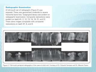 Periodontics case studies | PPTX