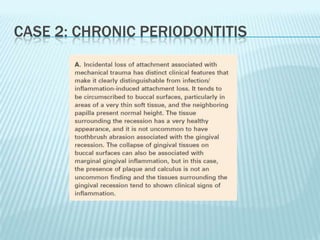 Periodontics case studies answers | PPT