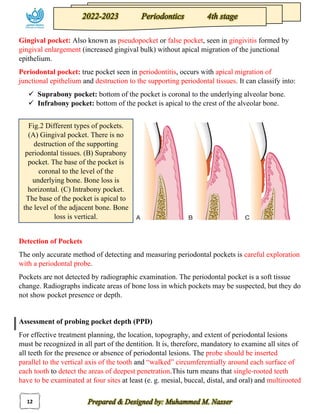 PERIODONTICS 4th stage | PDF