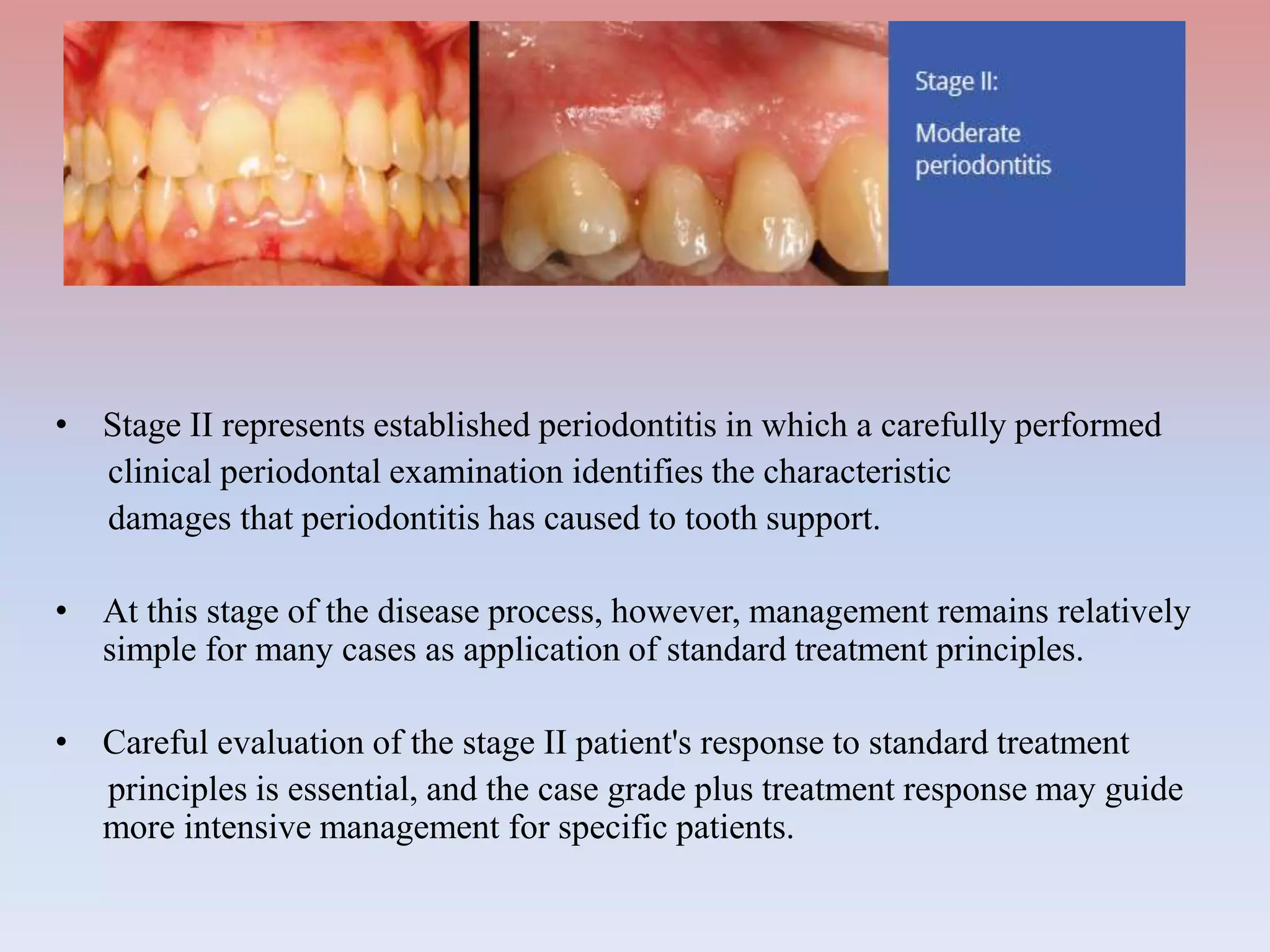 Periodontitis | PPTX