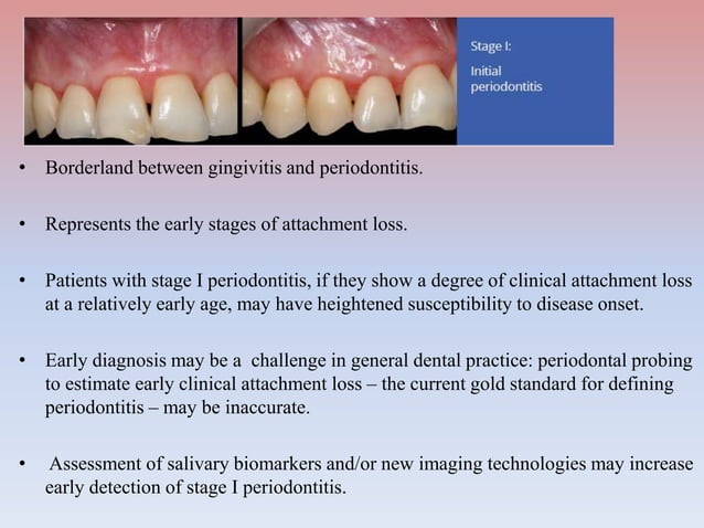 Periodontitis | PPTX | Oral care | Personal Care