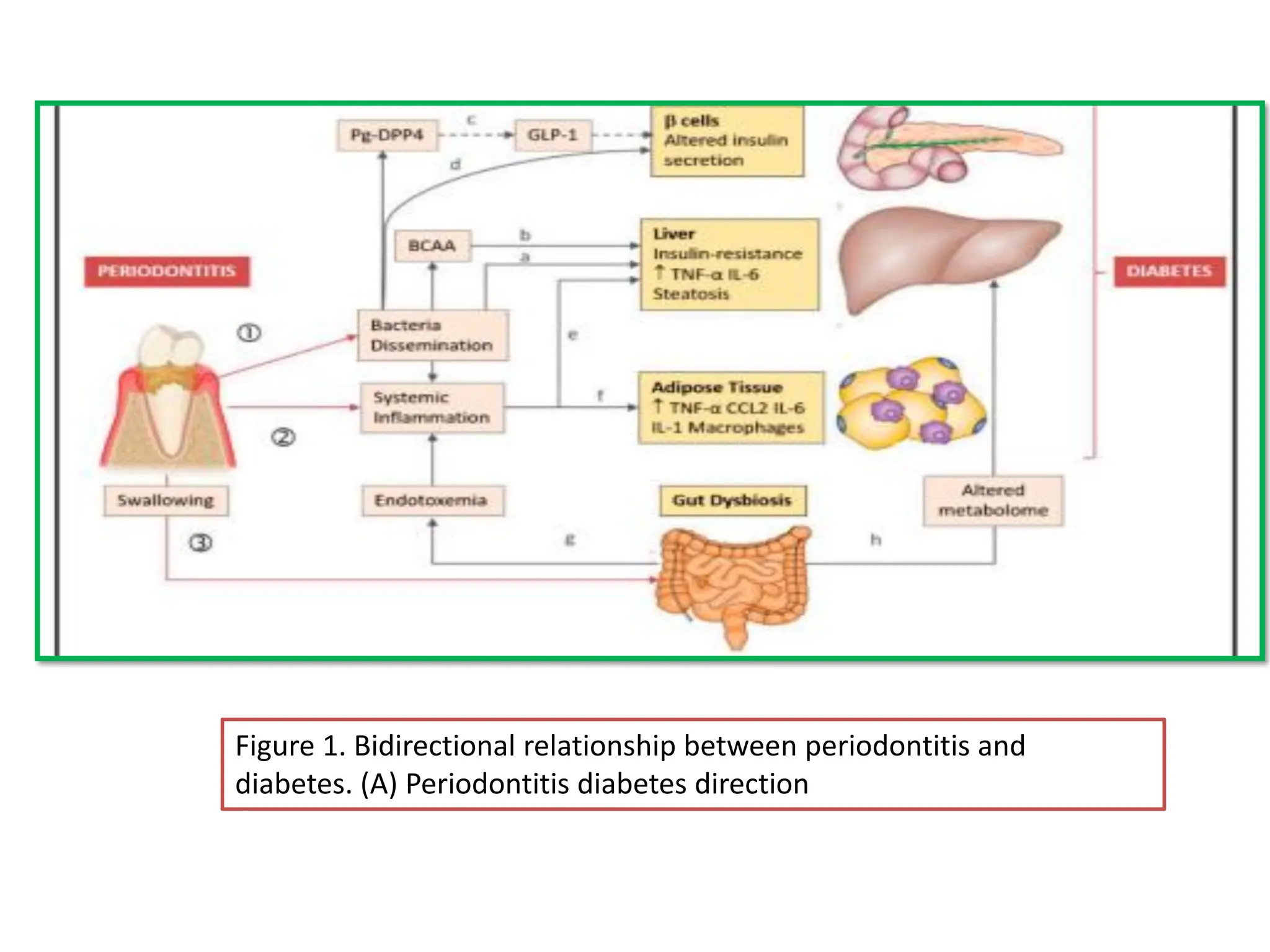 periodontitis-and-diabetes.pdf