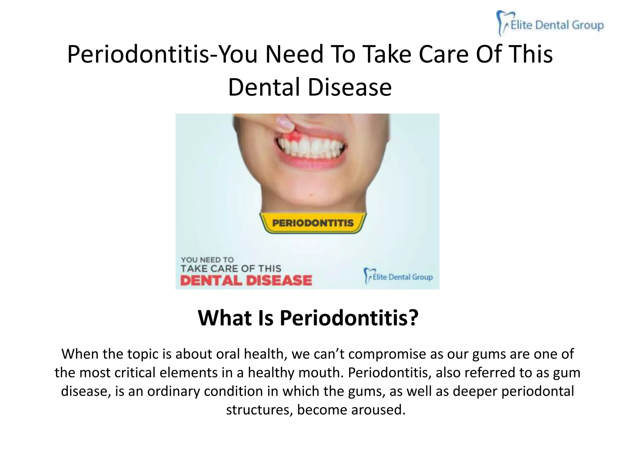 PERIODONTITIS-YOU NEED TO TAKE CARE OF THIS DENTAL DISEASE | PPT