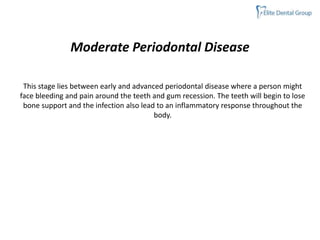PERIODONTITIS-YOU NEED TO TAKE CARE OF THIS DENTAL DISEASE | PPT | Free ...