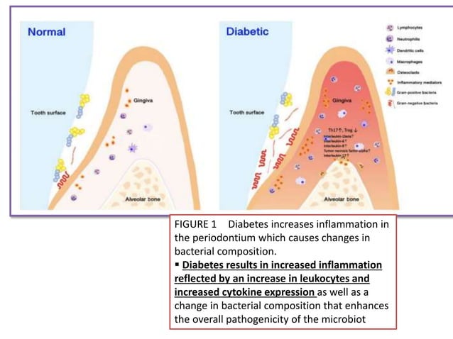 periodontitis and diabetes.pptx