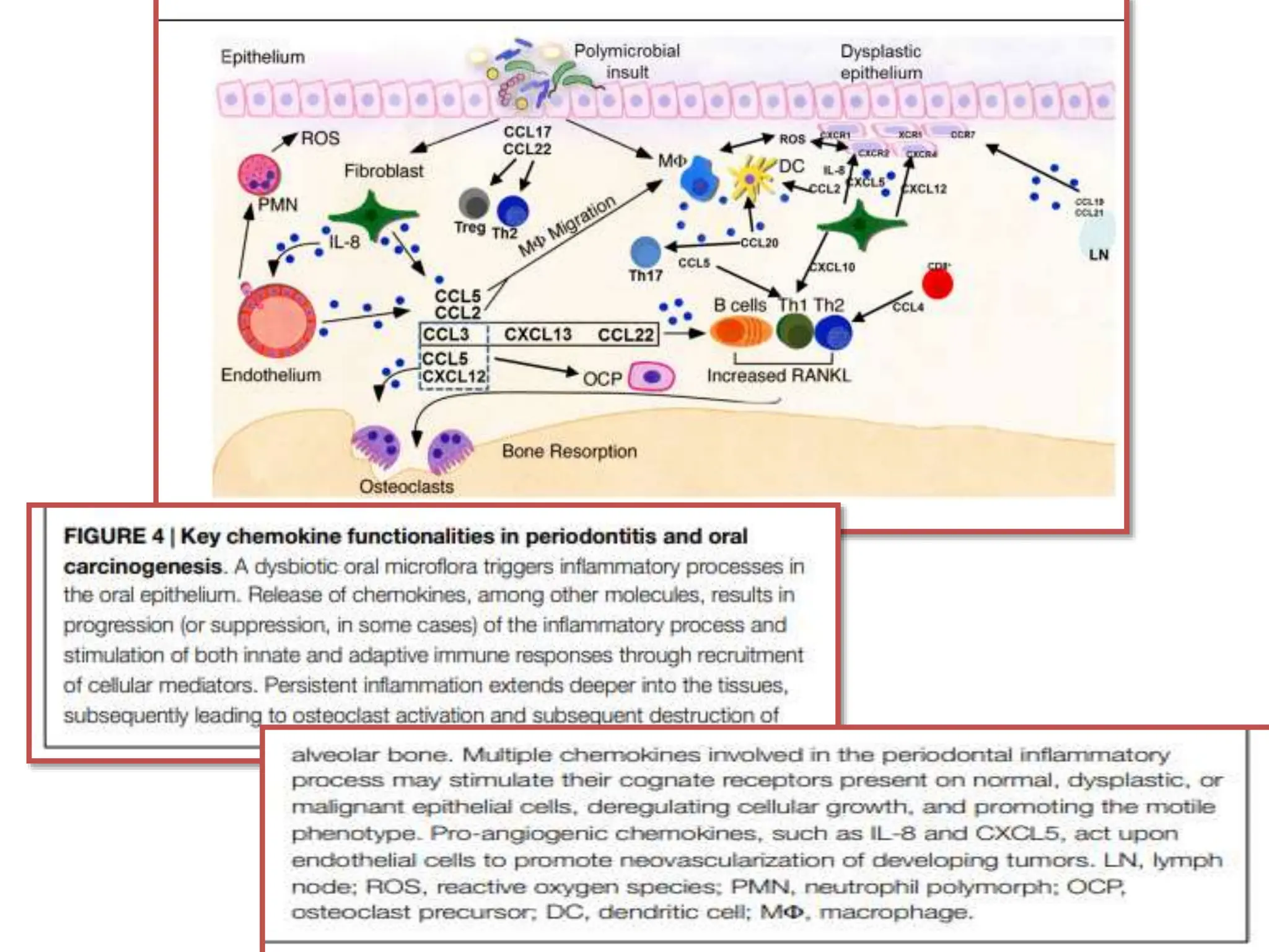 periodontitis and oral cancer.pptx