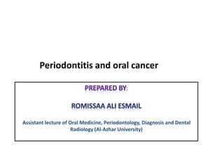 periodontitis and oral cancer.pptx