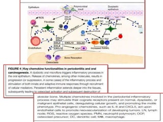 periodontitis and oral cancer.pptx