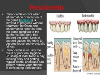 Periodontium | PPTX