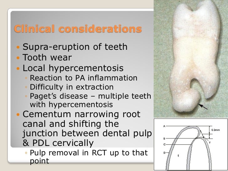 Periodontium brian