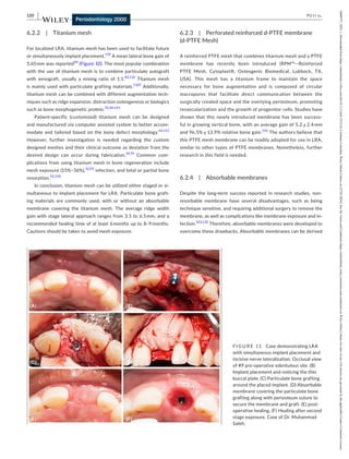 Periodontology 2000 - 2023 - Yu - Simultaneous or staged lateral ridge augmentation A clinical ...