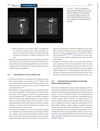 Periodontology 2000 - 2023 - Yu - Simultaneous or staged lateral ridge ...
