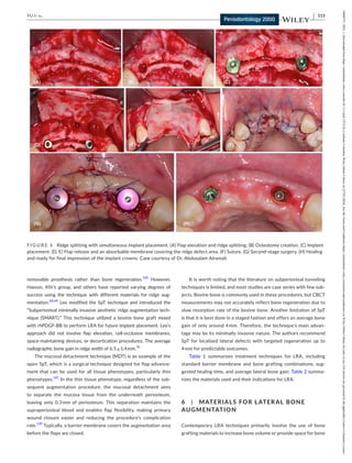 Periodontology 2000 - 2023 - Yu - Simultaneous or staged lateral ridge ...