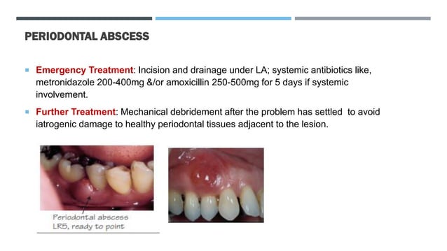 Plaque and Calculus | PDF | Oral care | Personal Care