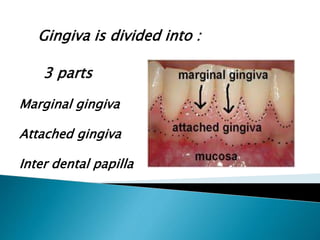 periodontologyttttttttttttt lecture.pptx