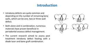 Laser Therapy On The Treatment Of Periodontal Bony Defects | PPT