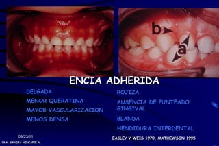 Periodonto normal en niños | PPT