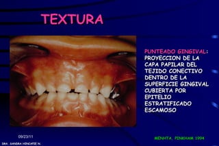 Periodonto normal en niños | PPT