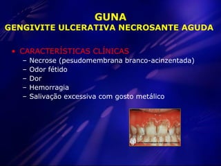 Periodontopatia blog | PPT