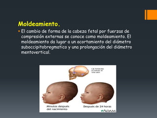 Periodo trabajo de parto(1) | PPTX