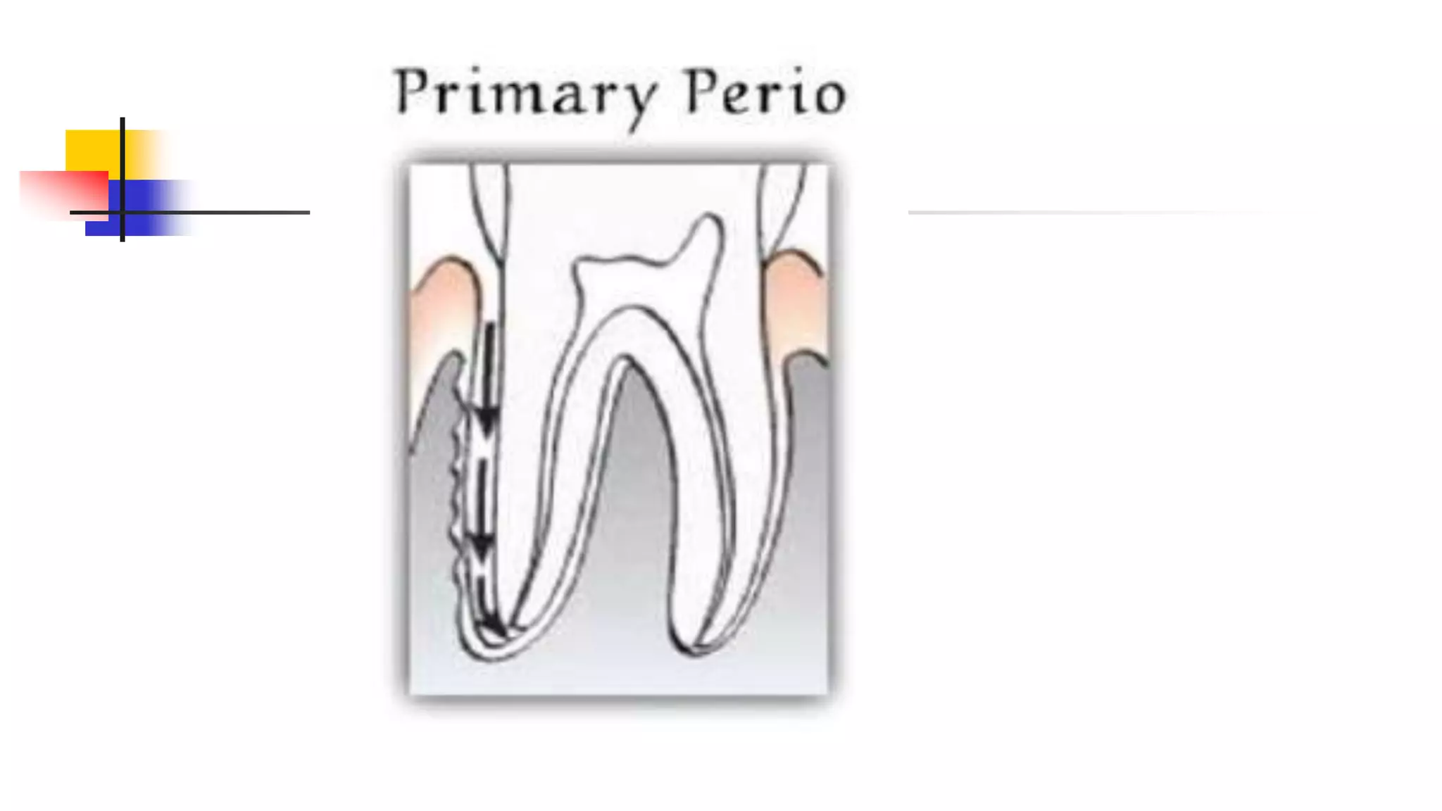 Perio endo lesion ojus | PPTX