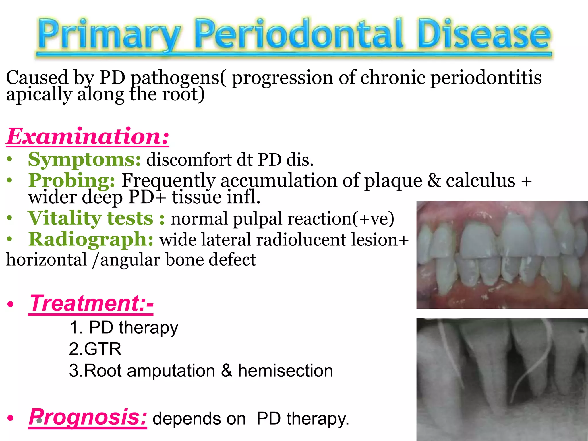 Periodontal endodontic lesions | PPTX