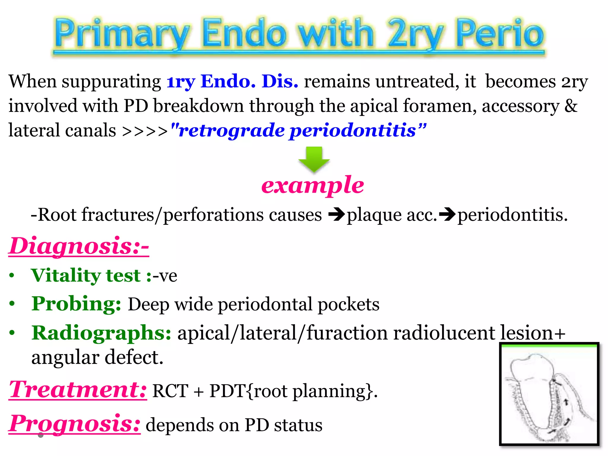 Periodontal endodontic lesions | PPTX