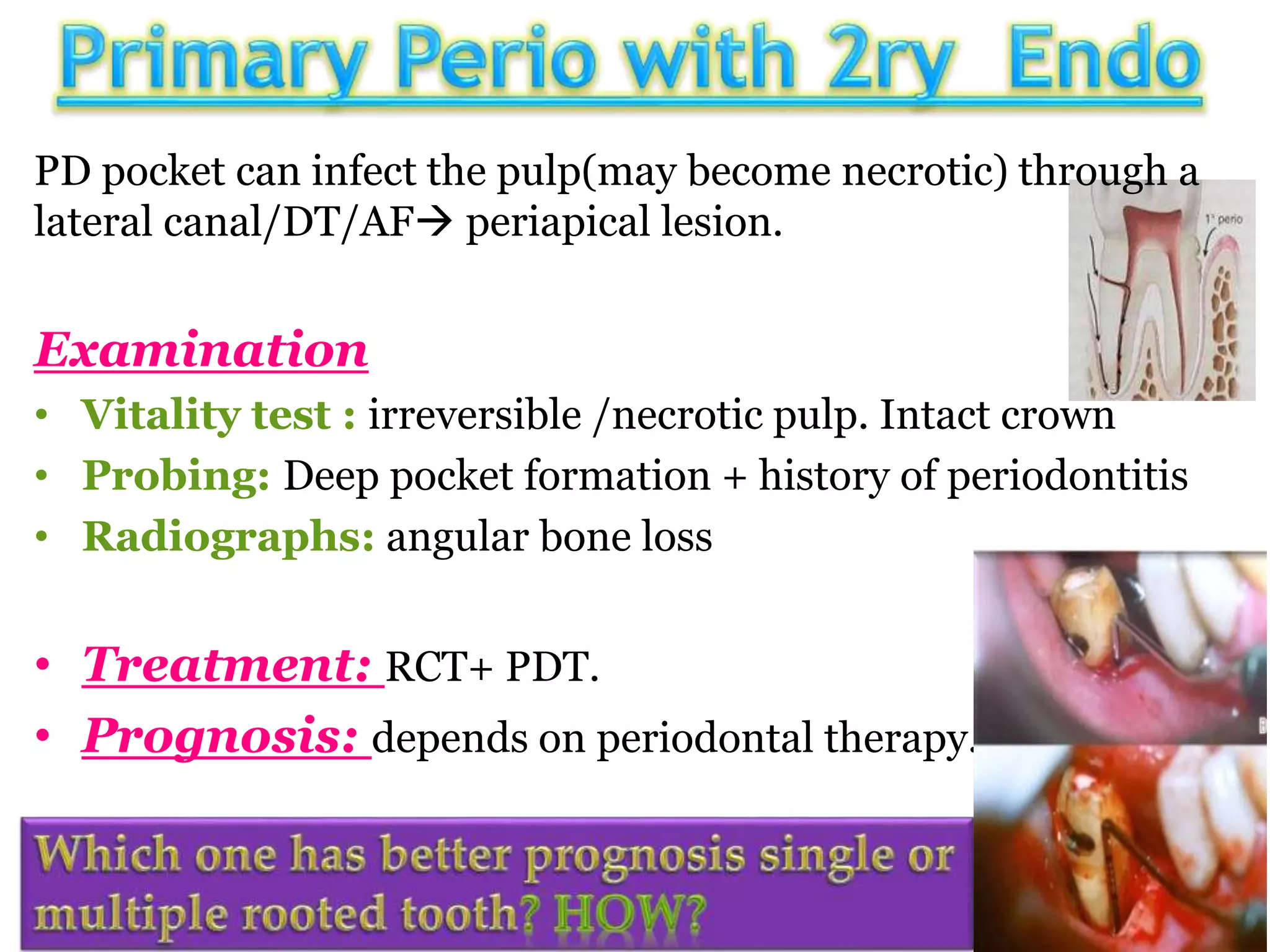 Periodontal endodontic lesions | PPTX