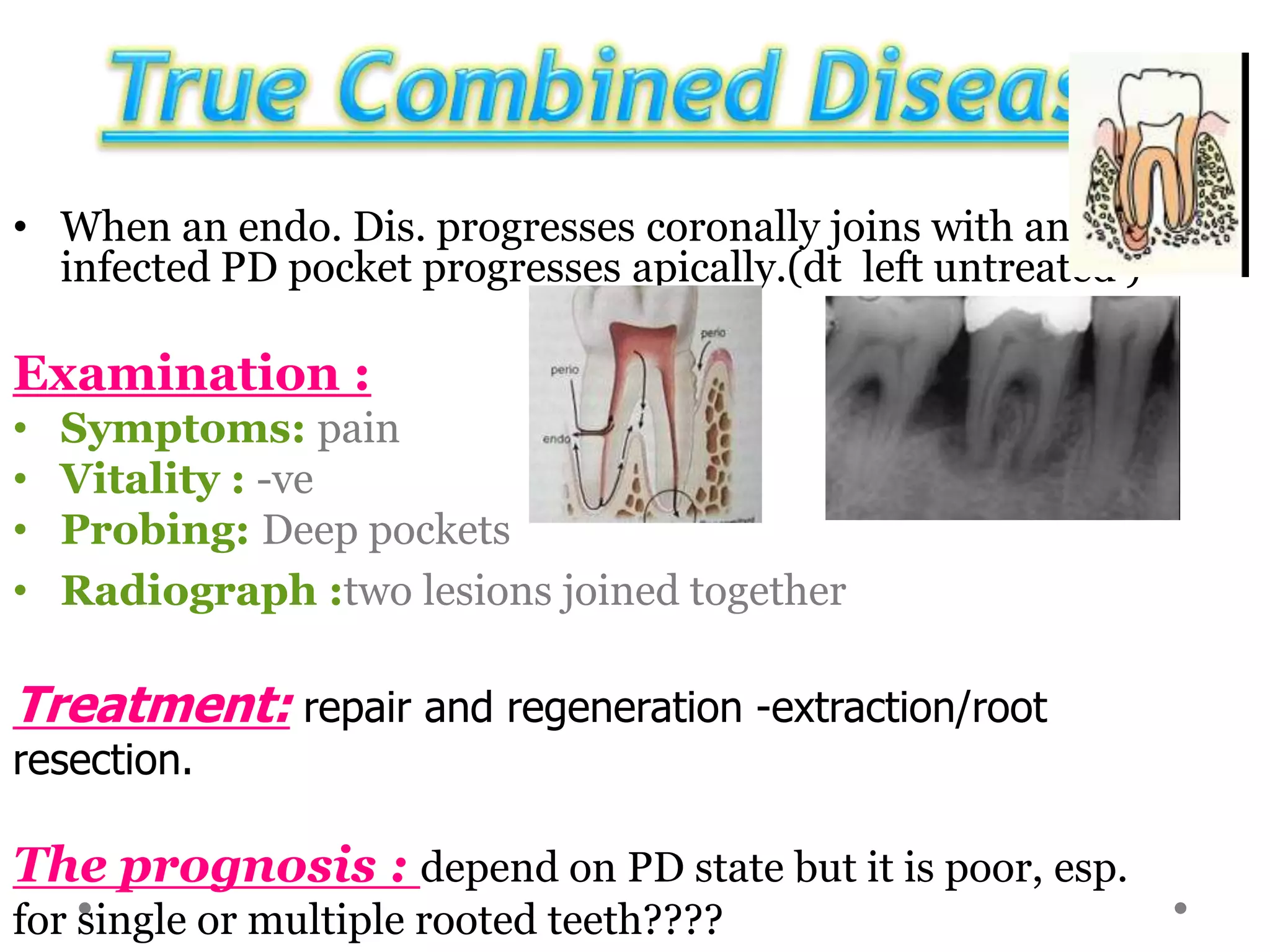 Periodontal endodontic lesions | PPTX