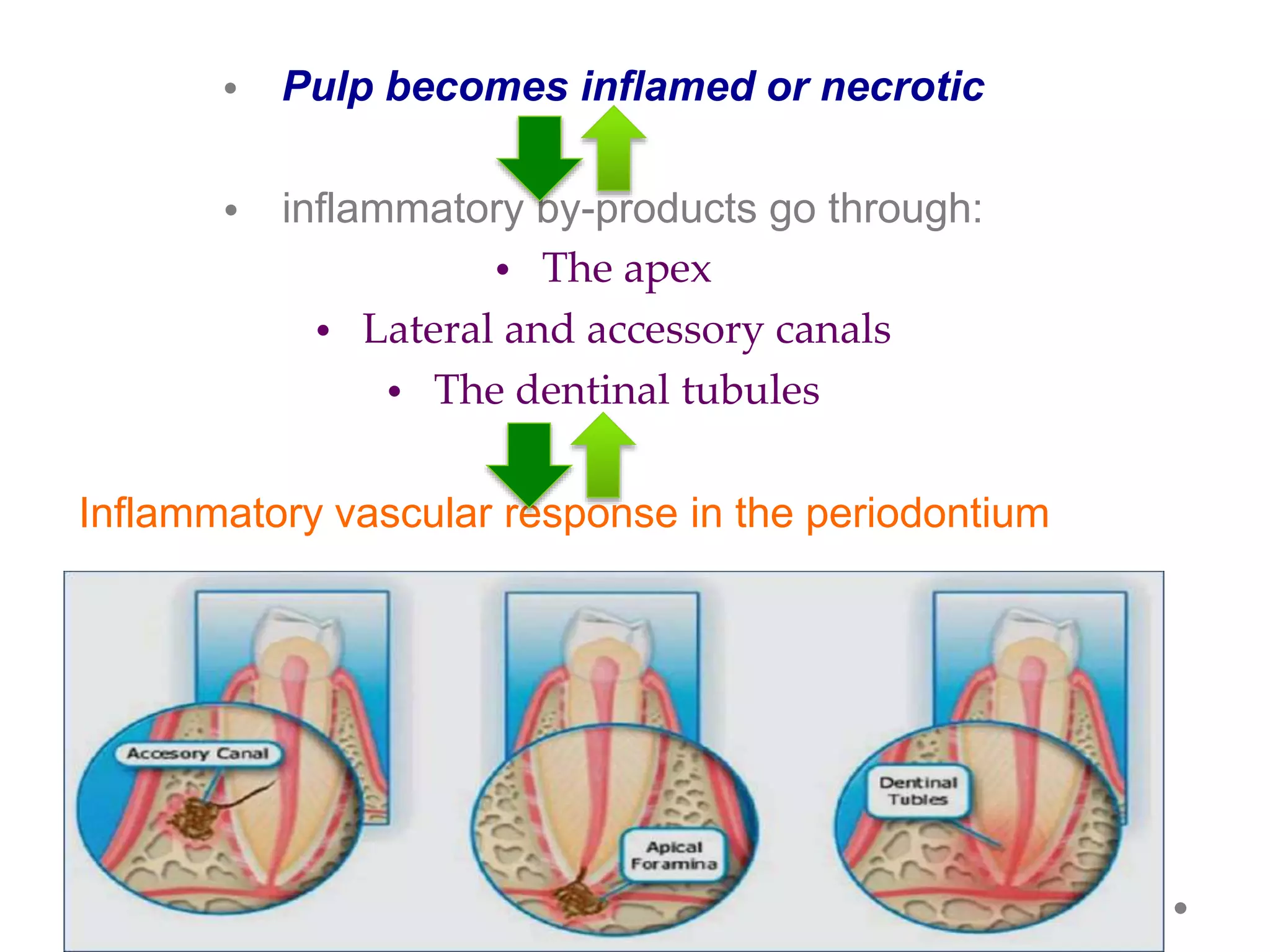 Periodontal endodontic lesions | PPTX