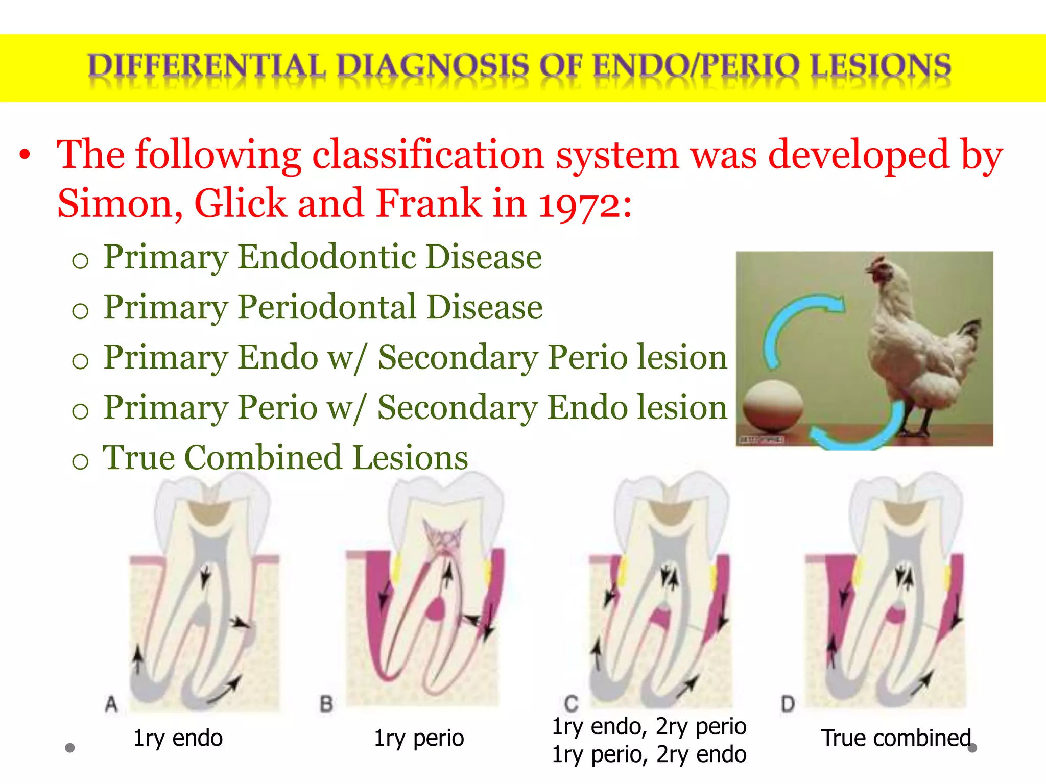 Periodontal endodontic lesions | PPTX