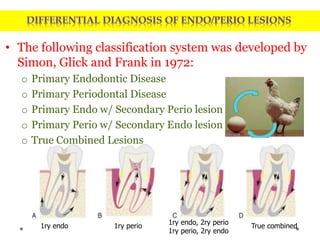 Periodontal endodontic lesions | PPTX